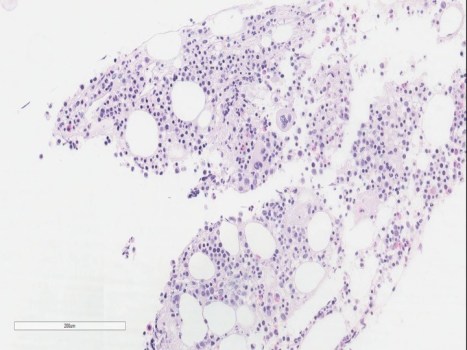 wm-corebiopsy – Lablogatory