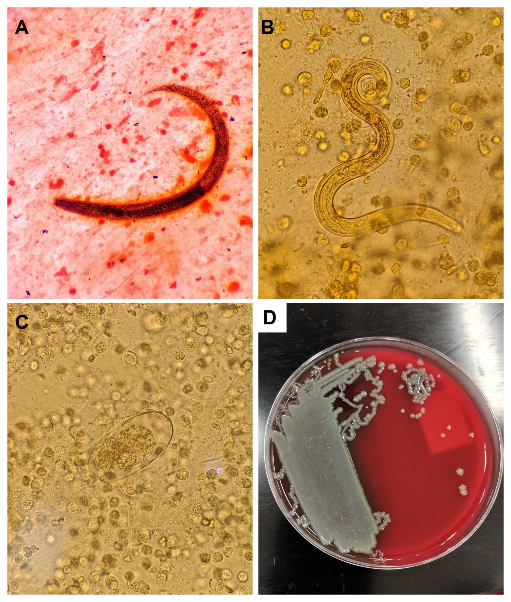 strong1 – Lablogatory