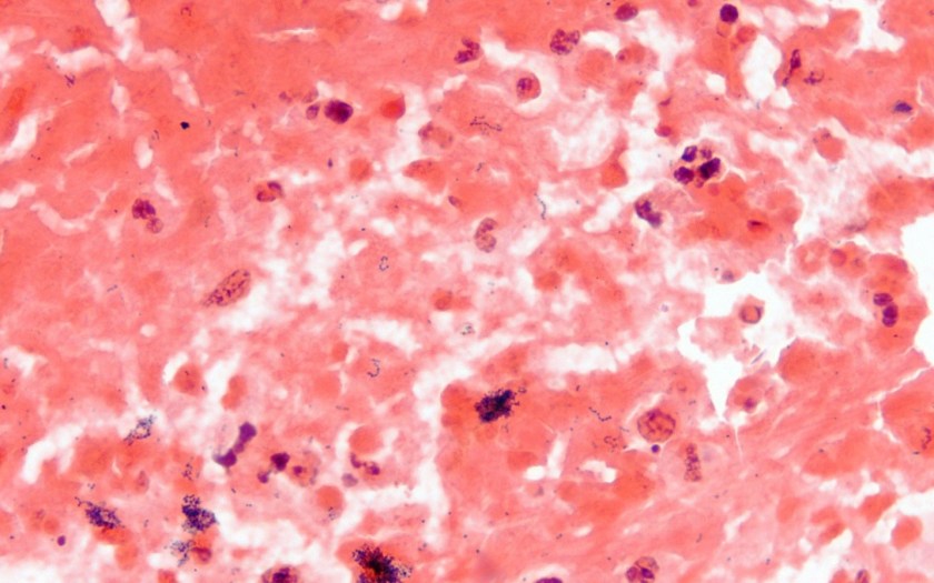 strint1 – Lablogatory