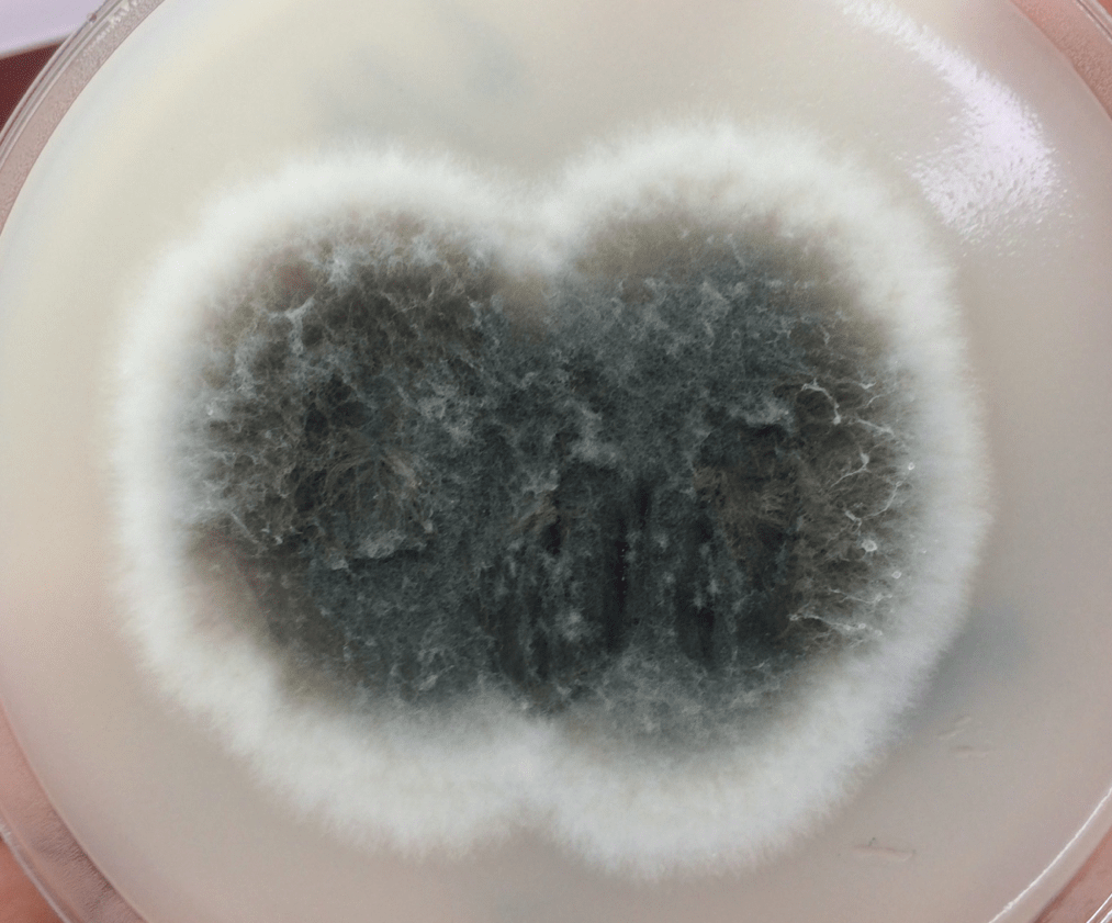 Microbiology Case Study: A 60 Year Old Male Status-Post Orthotopic ...