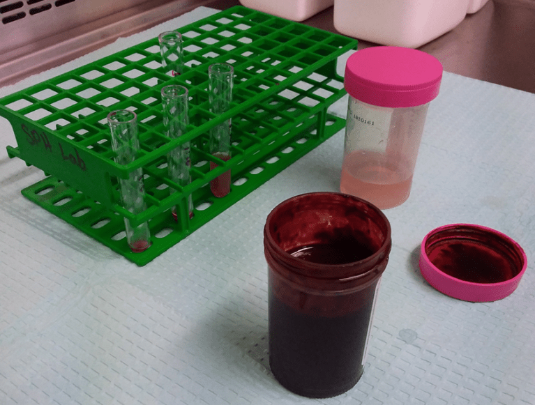 fobt-1 – Lablogatory