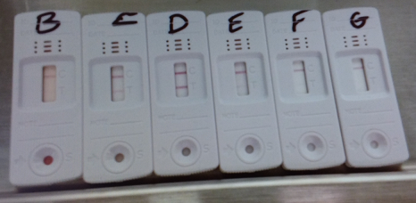Prozone Effect in the Fecal Immunochemical Test (FIT) – Lablogatory