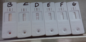 Prozone Effect in the Fecal Immunochemical Test (FIT) – Lablogatory