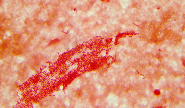 salent1 – Lablogatory