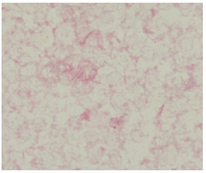 ratbiteimg1 – Lablogatory