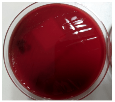 ratbiteimg2 – Lablogatory