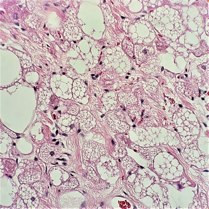 hiber7 – Lablogatory