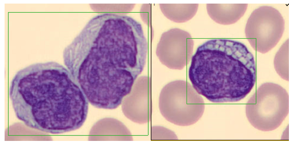 Case Study Hematology: The Mouse Strikes again! Lymphocytes with ...