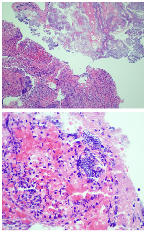 rothia3 – Lablogatory