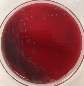 Microbiology Case Study: 68 Year Old Female with Streptococcus ...