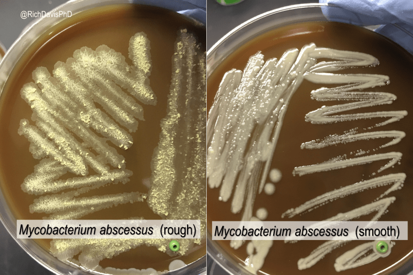 A Cording Too: “Cording” in Clinical Isolates of Mycobacterium ...