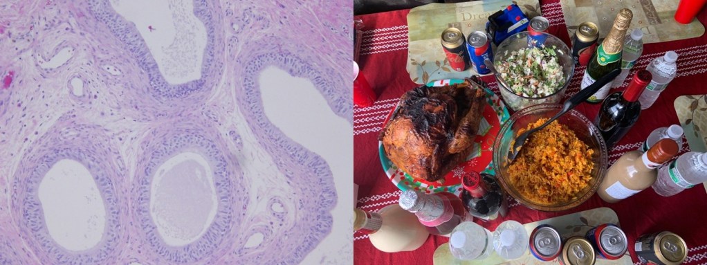 A Trilogy of Food, Fun, and Facts: Musings of a Pathologist-in-Training ...