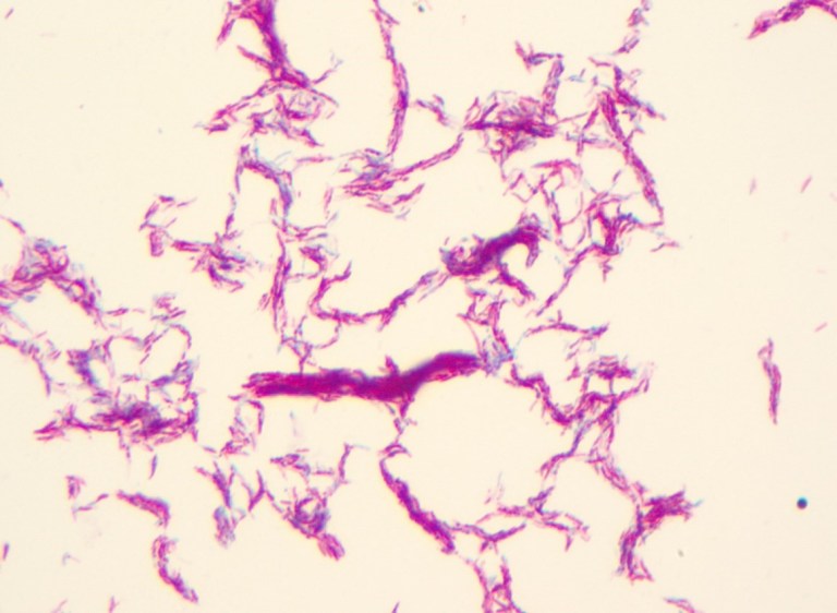 microbiology – Page 10 – Lablogatory