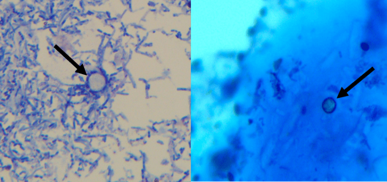 Microbiology Case Study: Salads, Stool, and Special Staining Studies ...