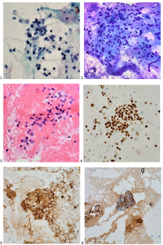 renalmet1 – Lablogatory