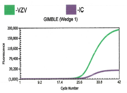 vzv3 – Lablogatory