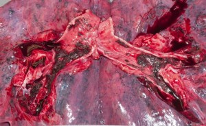 The Basics of Deaths by Fire: Answering Your Burning Questions ...