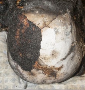 The Basics of Deaths by Fire: Answering Your Burning Questions ...