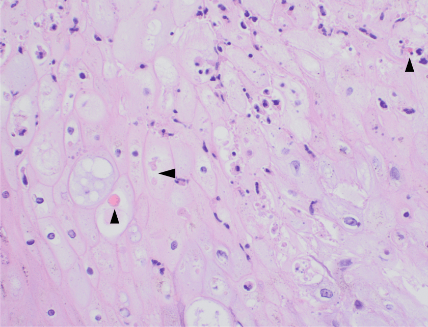 The Latest Pox, Up Close and Personal – Lablogatory