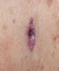 The Ins and Outs of Gunshot Wounds – Lablogatory