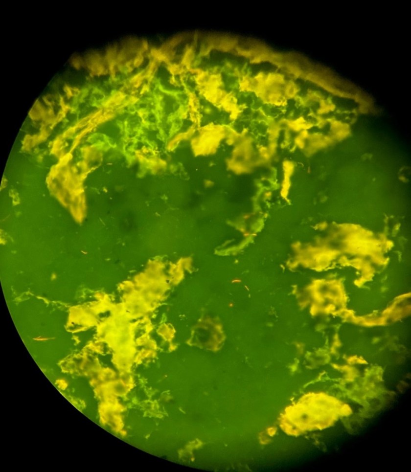 microbiology – Lablogatory