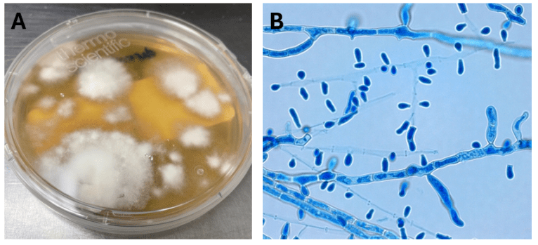 microbiology – Lablogatory